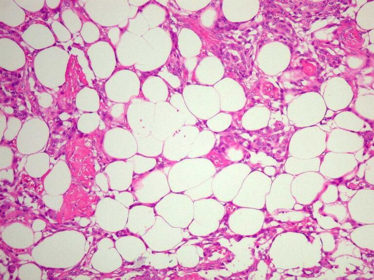 Tecido Adiposo: Tipos e Reserva de Energia - Biomedicina Online